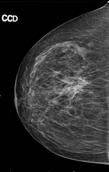 cranio caudale image numérique